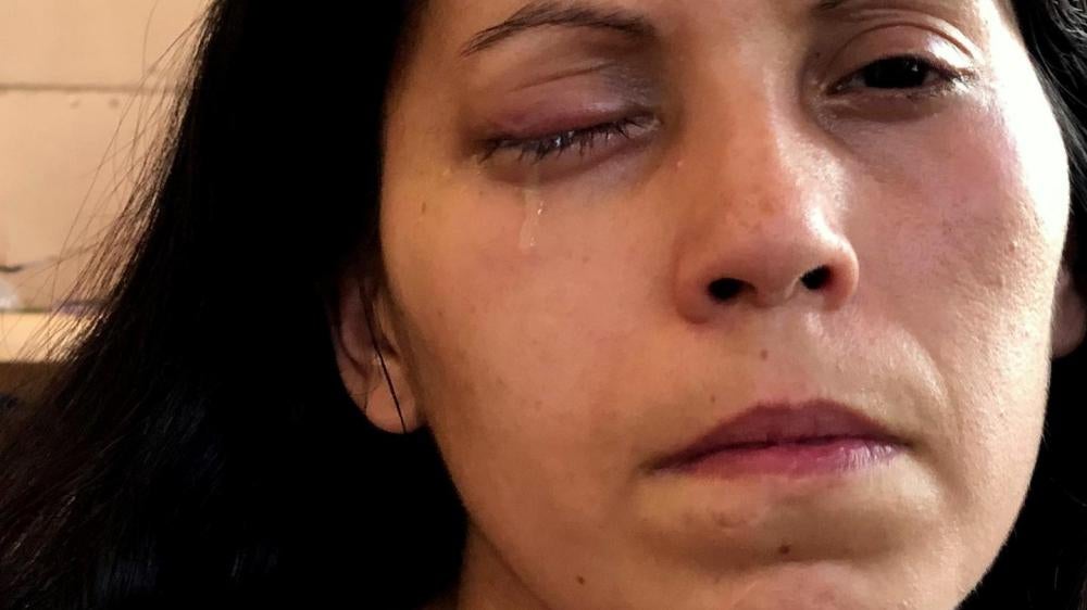 World Report 2020: Chile | Human Rights Watch