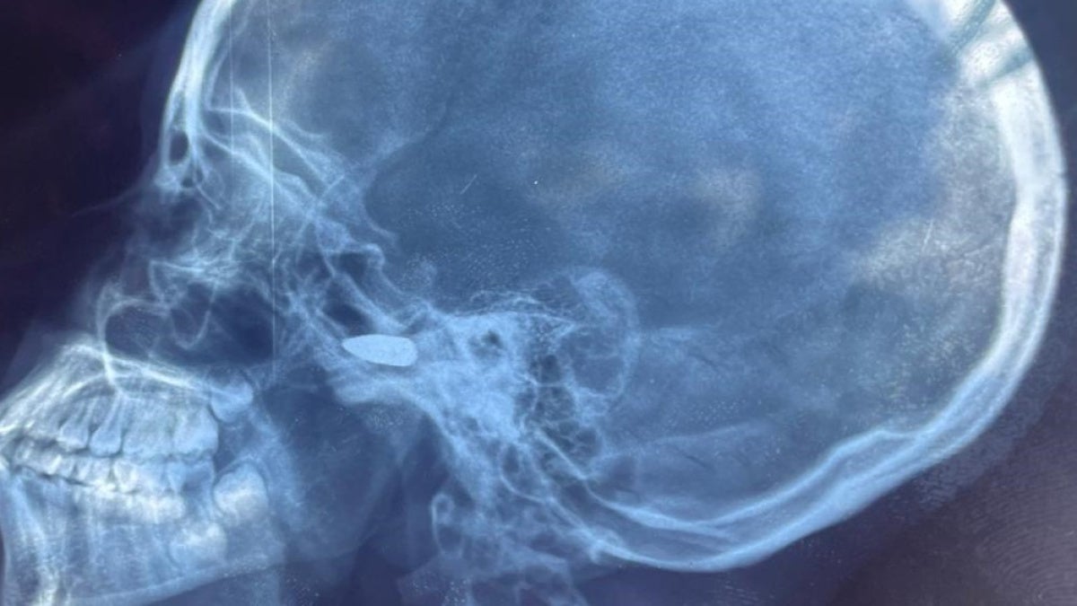 Chad celebratory shooting x-rays | Human Rights Watch